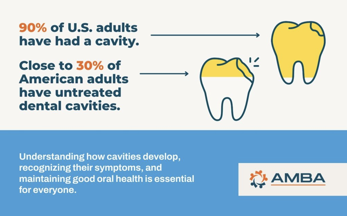 AMBA’s Essential Insights in Dental Health: Understanding Cavities Blog